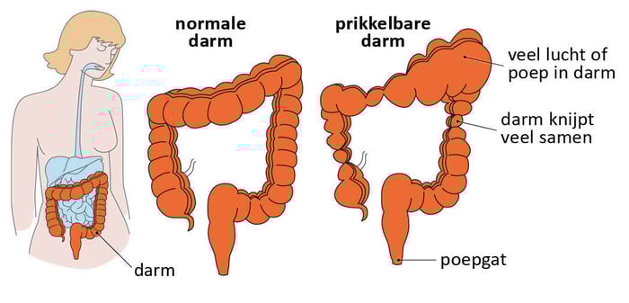Pijn in de Rechter Onderbuik: Oorzaken, Symptomen en Behandeling